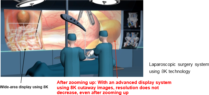 First National Project Using 8K Super Hi-Vision Technology for Medical ...