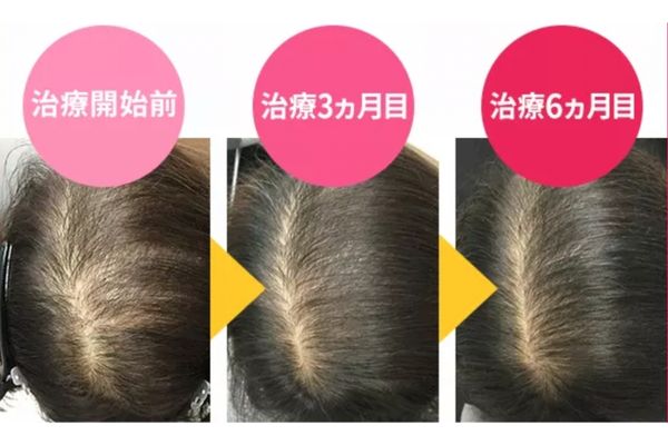 ”失敗しない”FAGAクリニックの選び方