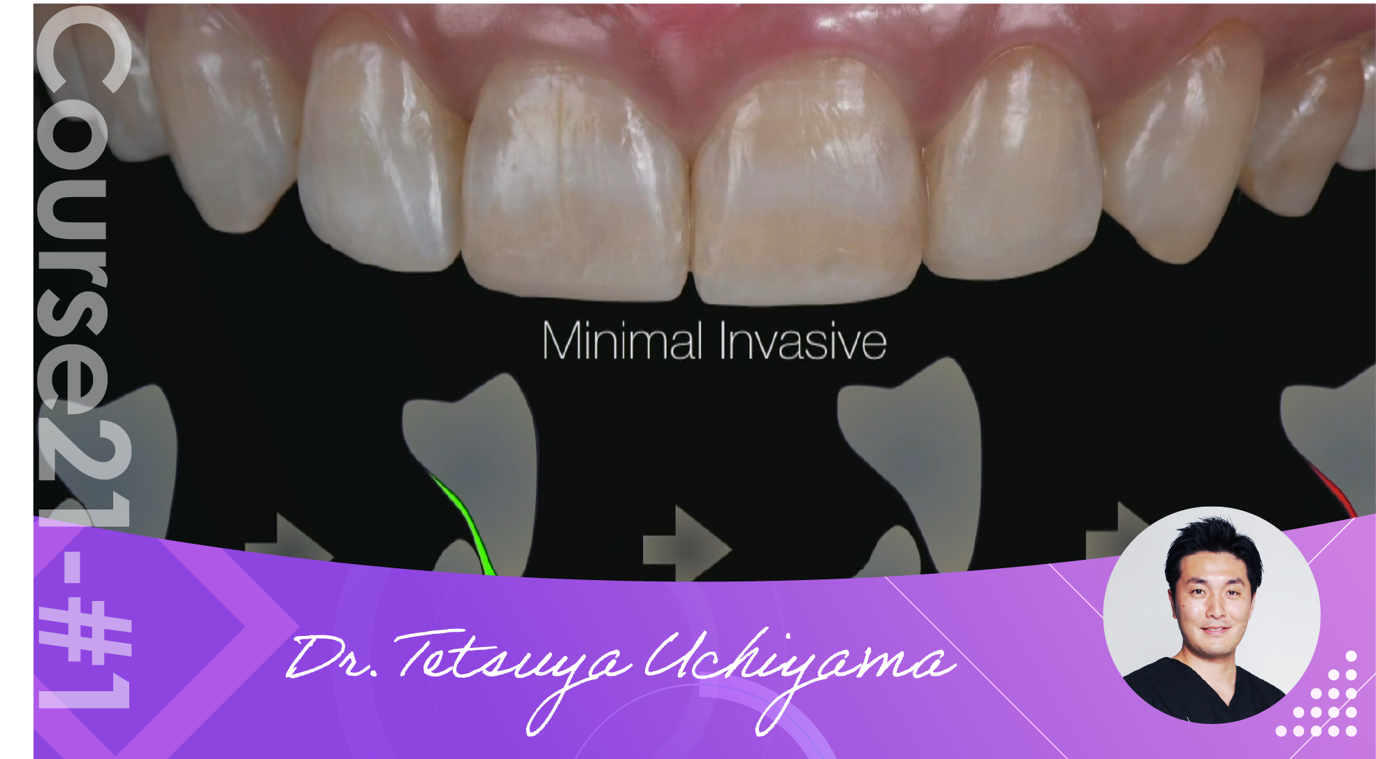 #1 Vertical Diagnosis in Craniofacial | Doctorbook global academy
