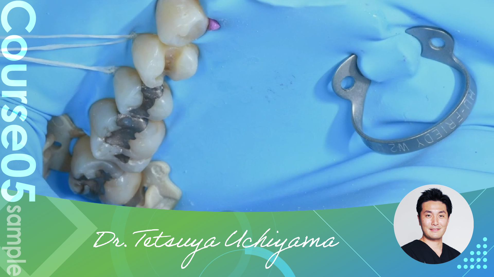 【sample】Rubber Dam Isolation | Doctorbook global academy