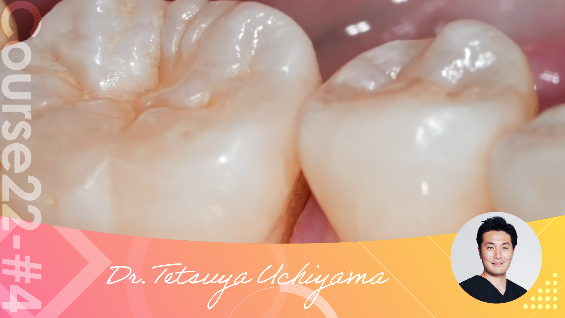 #4 Flowable Resin and Instruments | Doctorbook global academy