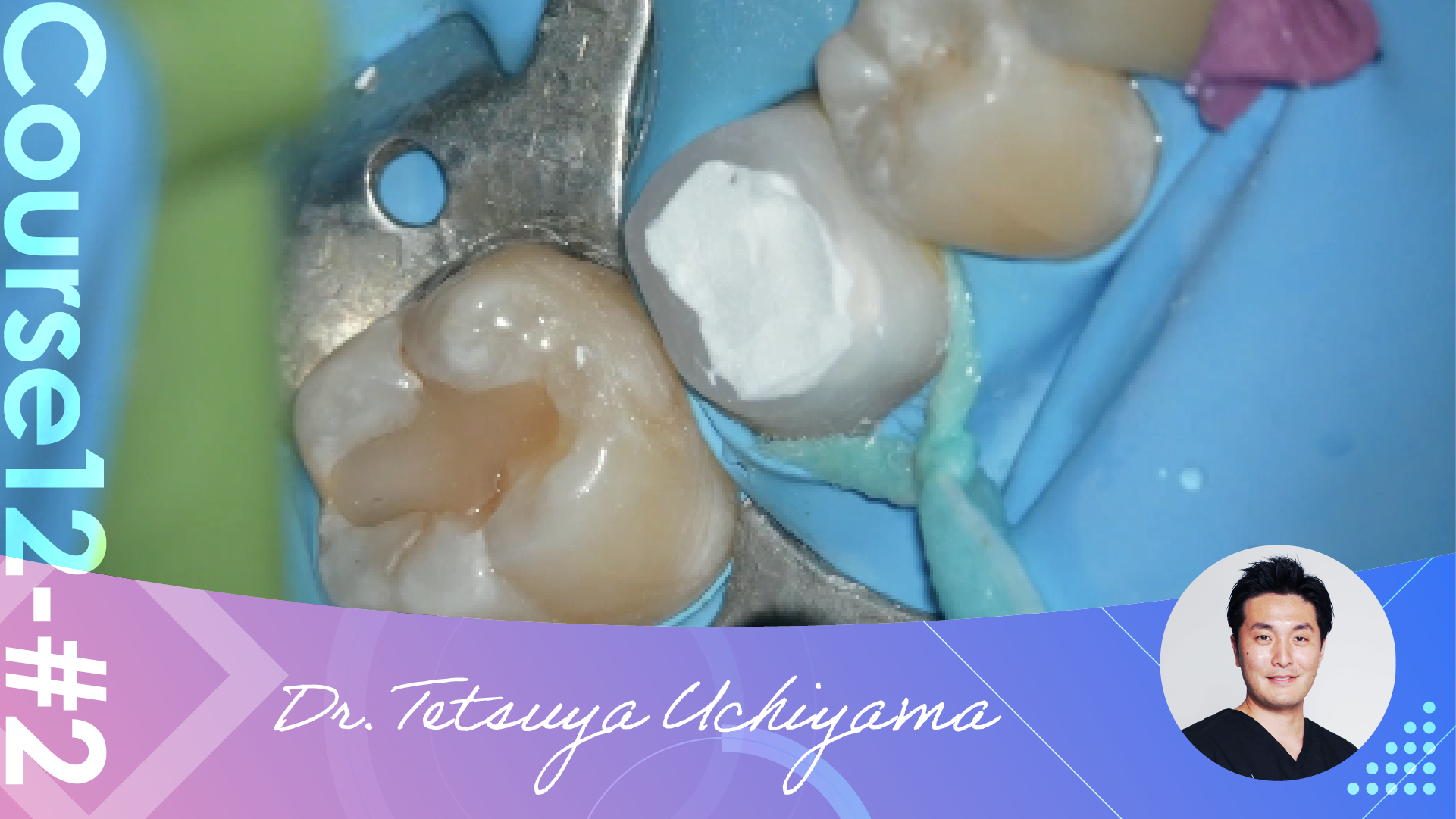 #2 Caviton to CAP day2 and beyond Treatment flow from RCT to core ...