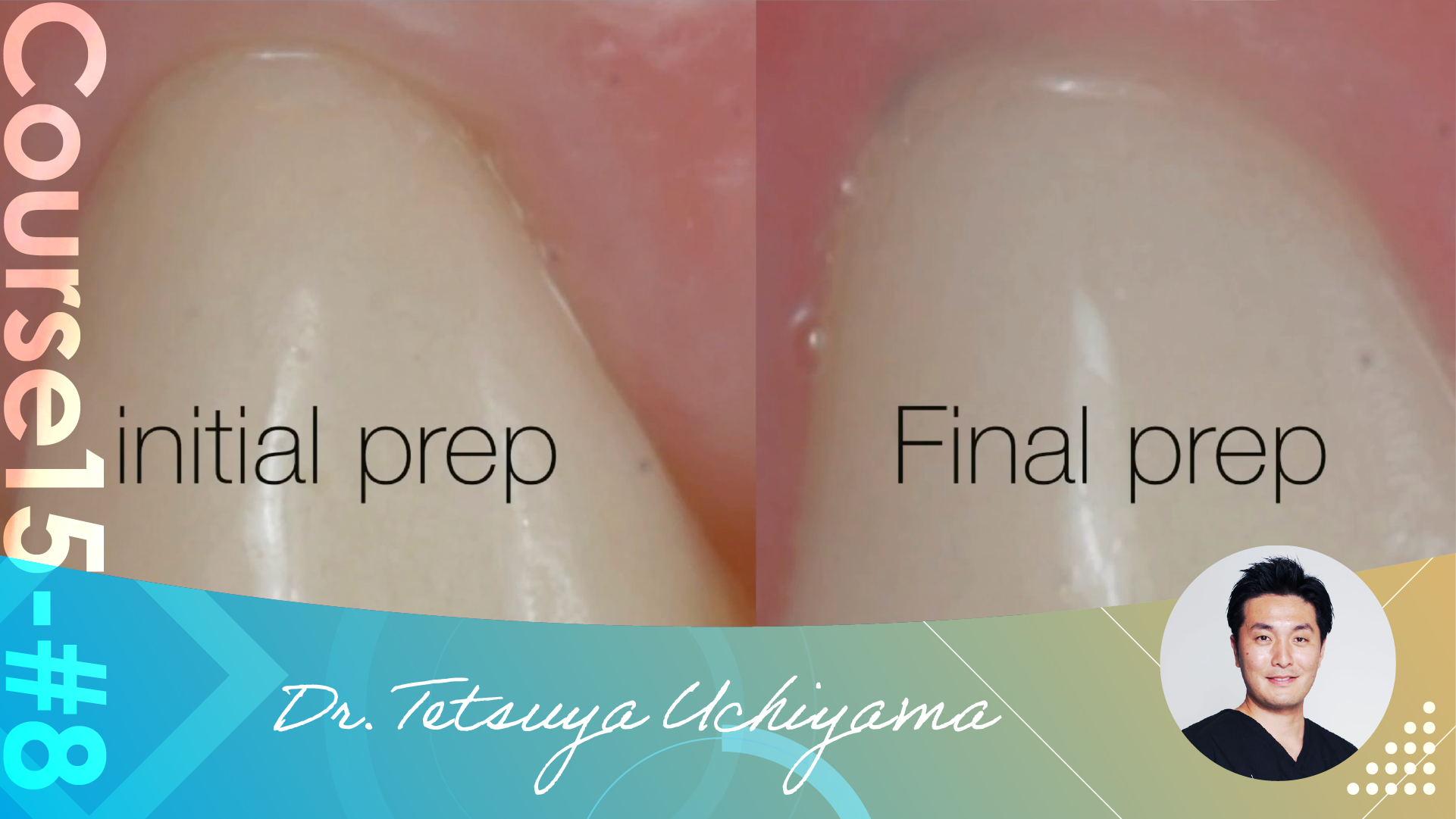 #8 Setting up an emergence profile | Doctorbook global academy