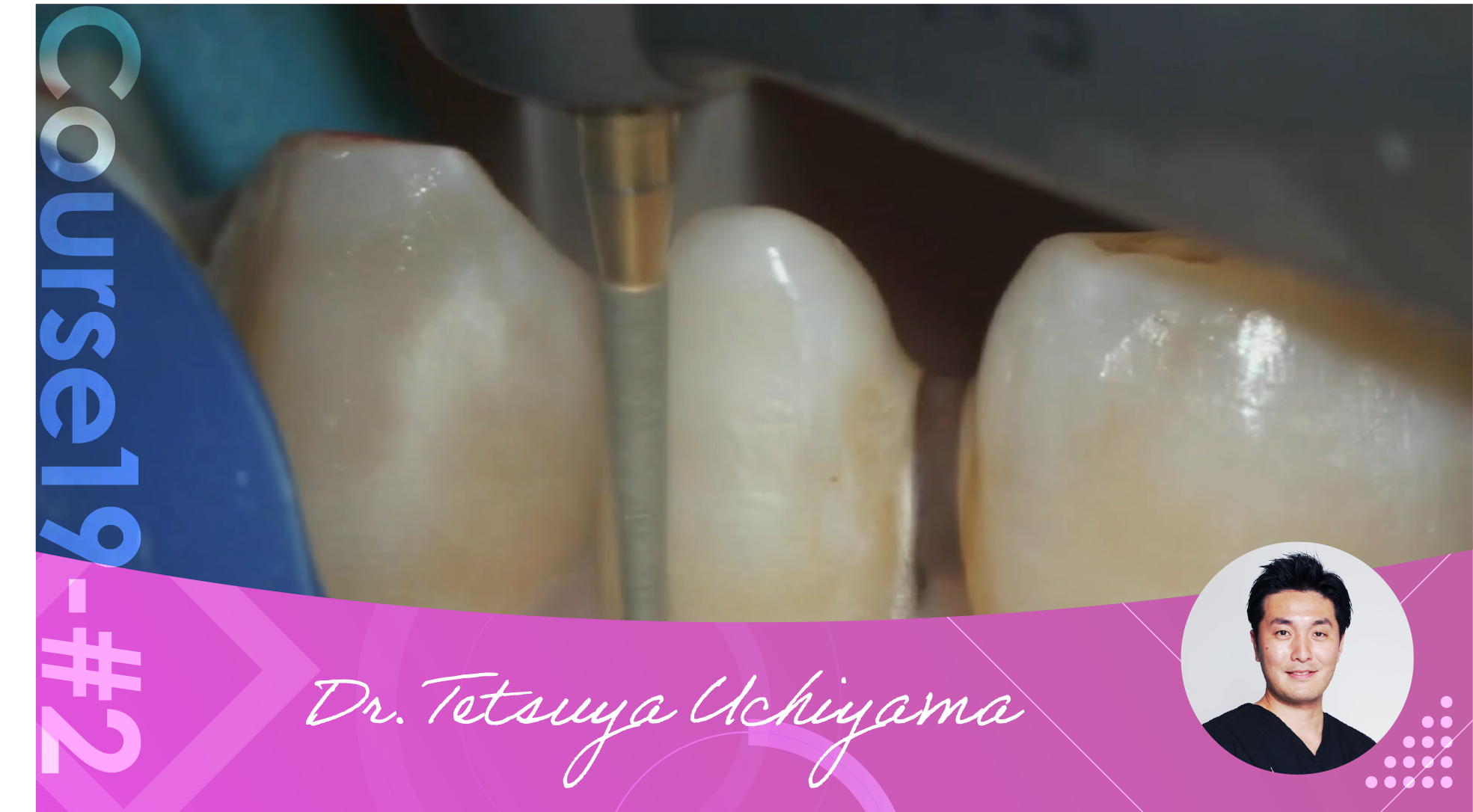 #2 Preoperative checkpoints in the aesthetic field | Doctorbook global ...