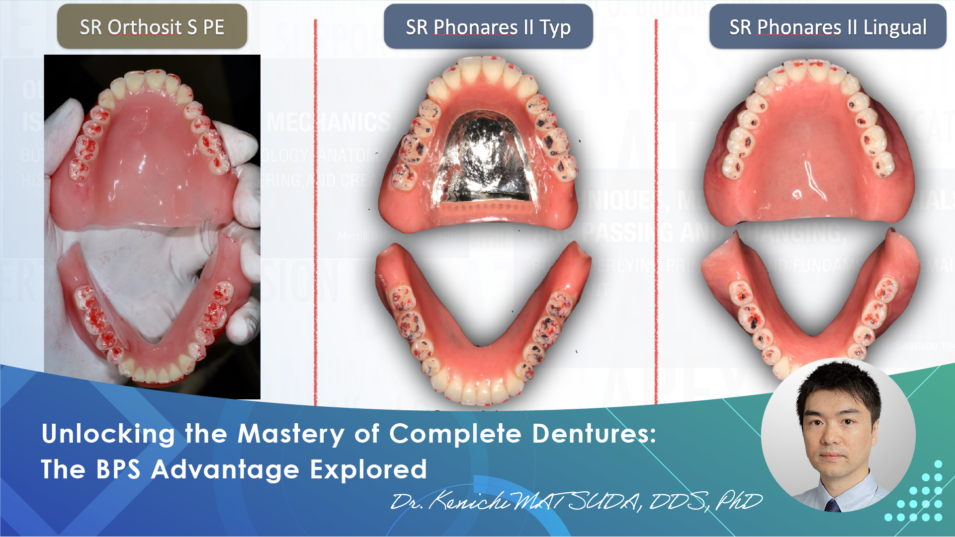 Unlocking the Mastery of Complete Dentures: The BPS Advantage Explored ...